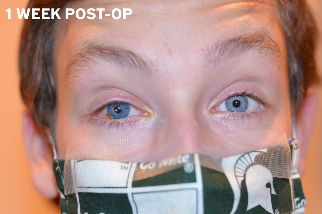 Northern Michigan’s First Team of Surgeons to Implant a Customflex ...