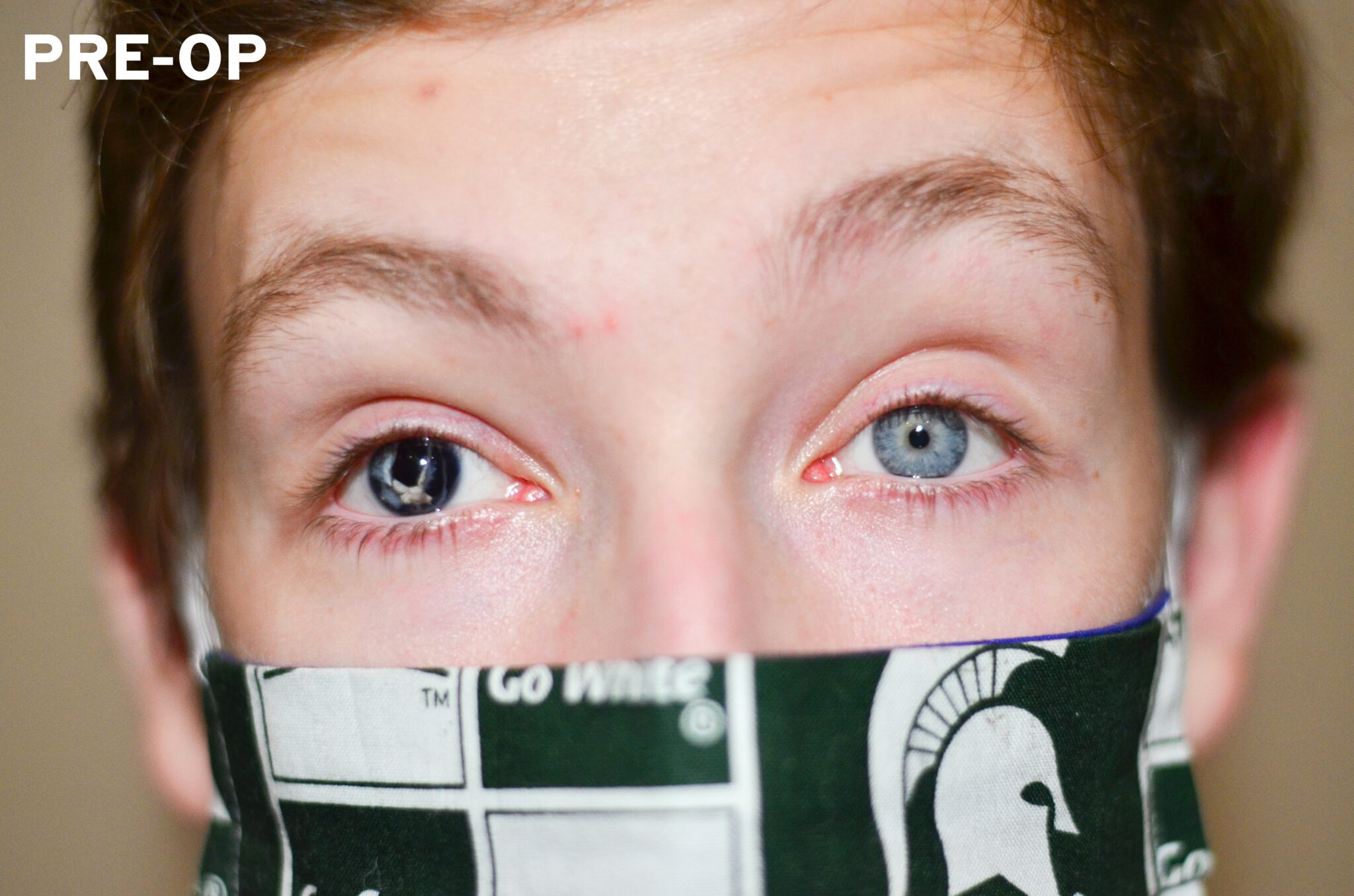 Northern Michigan’s First Team of Surgeons to Implant a Customflex ...